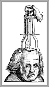 Trepanation-Gersdorff-1517.jpg